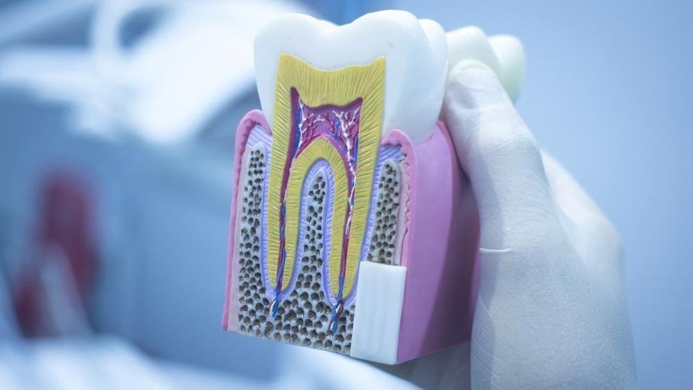 Tooth Enamel Loss | Orchards Dental Blog